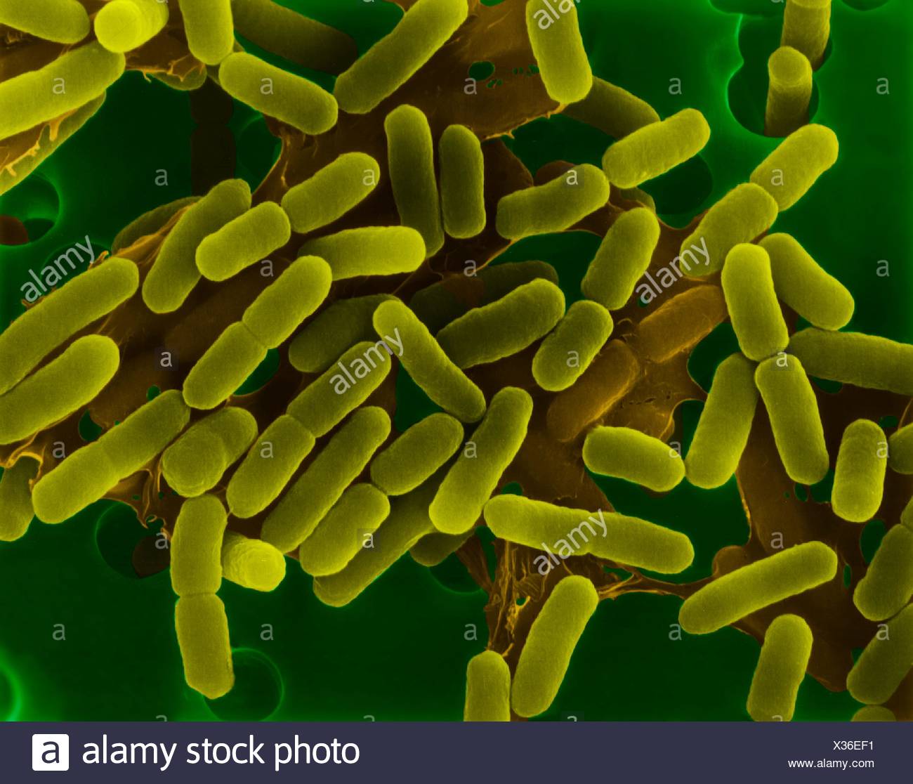 Enteric Bacterial Pathogen High Resolution Stock Photography and Images ...