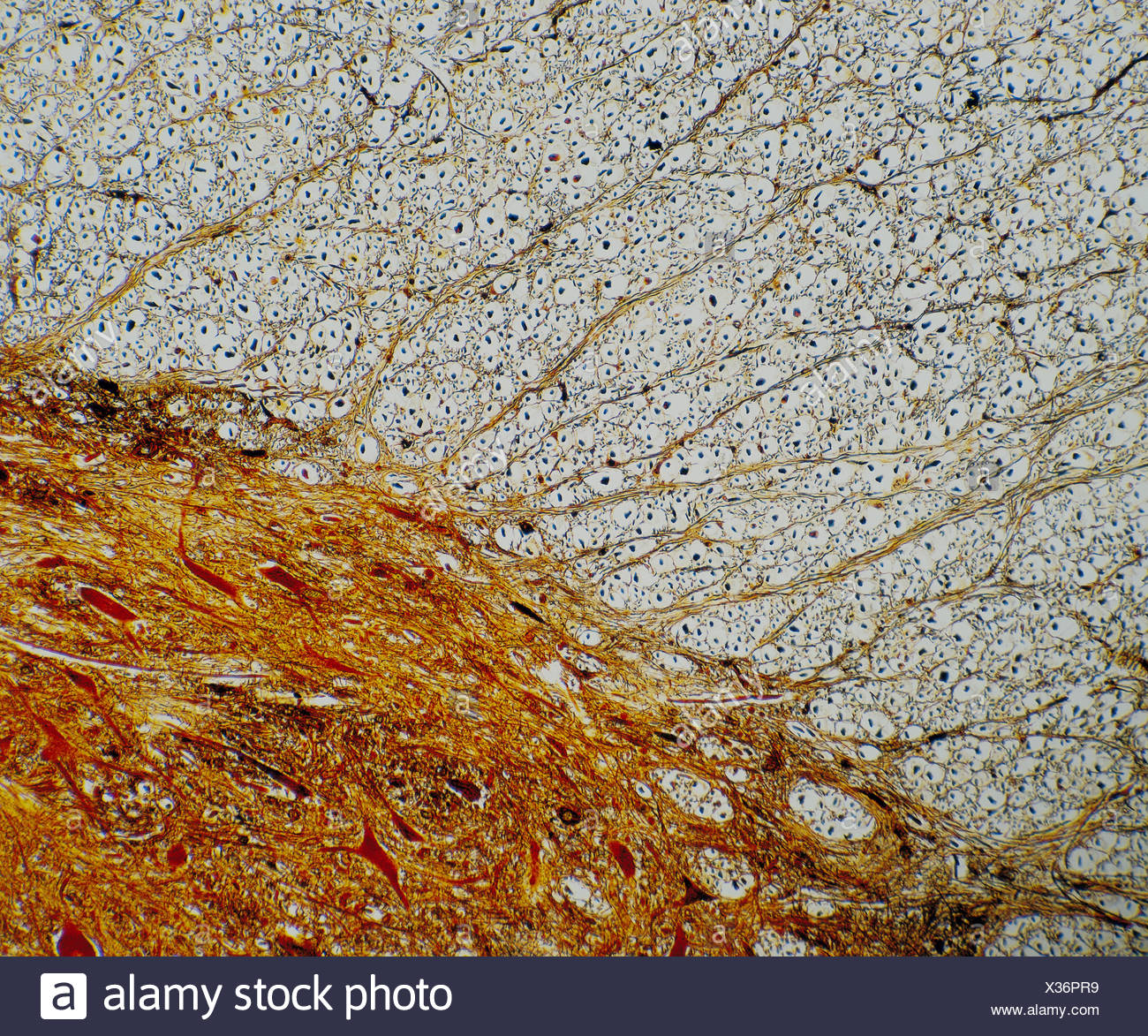Medulla Spinalis High Resolution Stock Photography and Images - Alamy