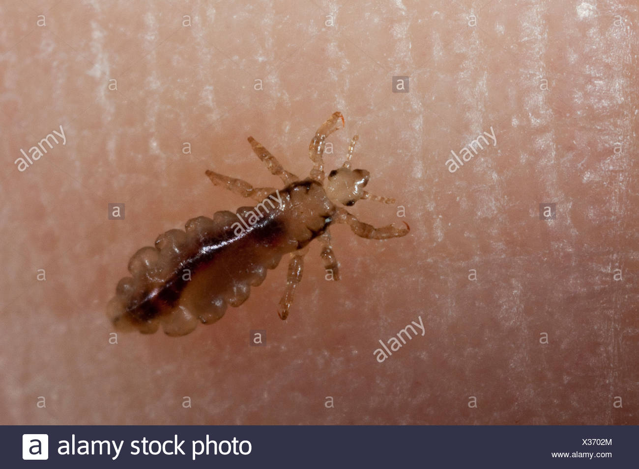 Pediculus Stock Photos & Pediculus Stock Images - Alamy