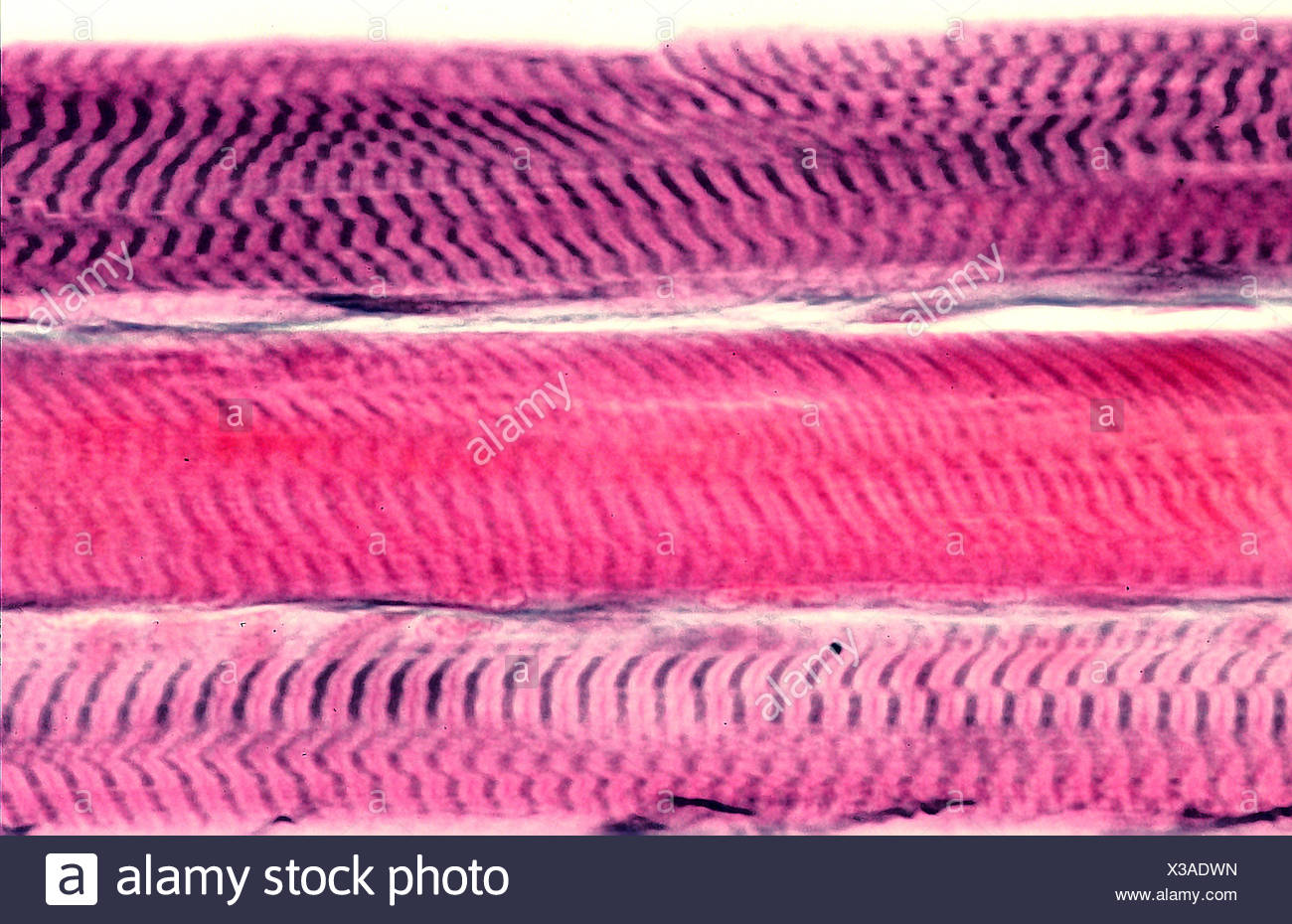 Striated Muscle High Resolution Stock Photography and Images - Alamy