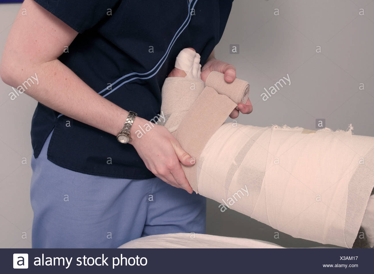 Swollen Legs High Resolution Stock Photography and Images - Alamy