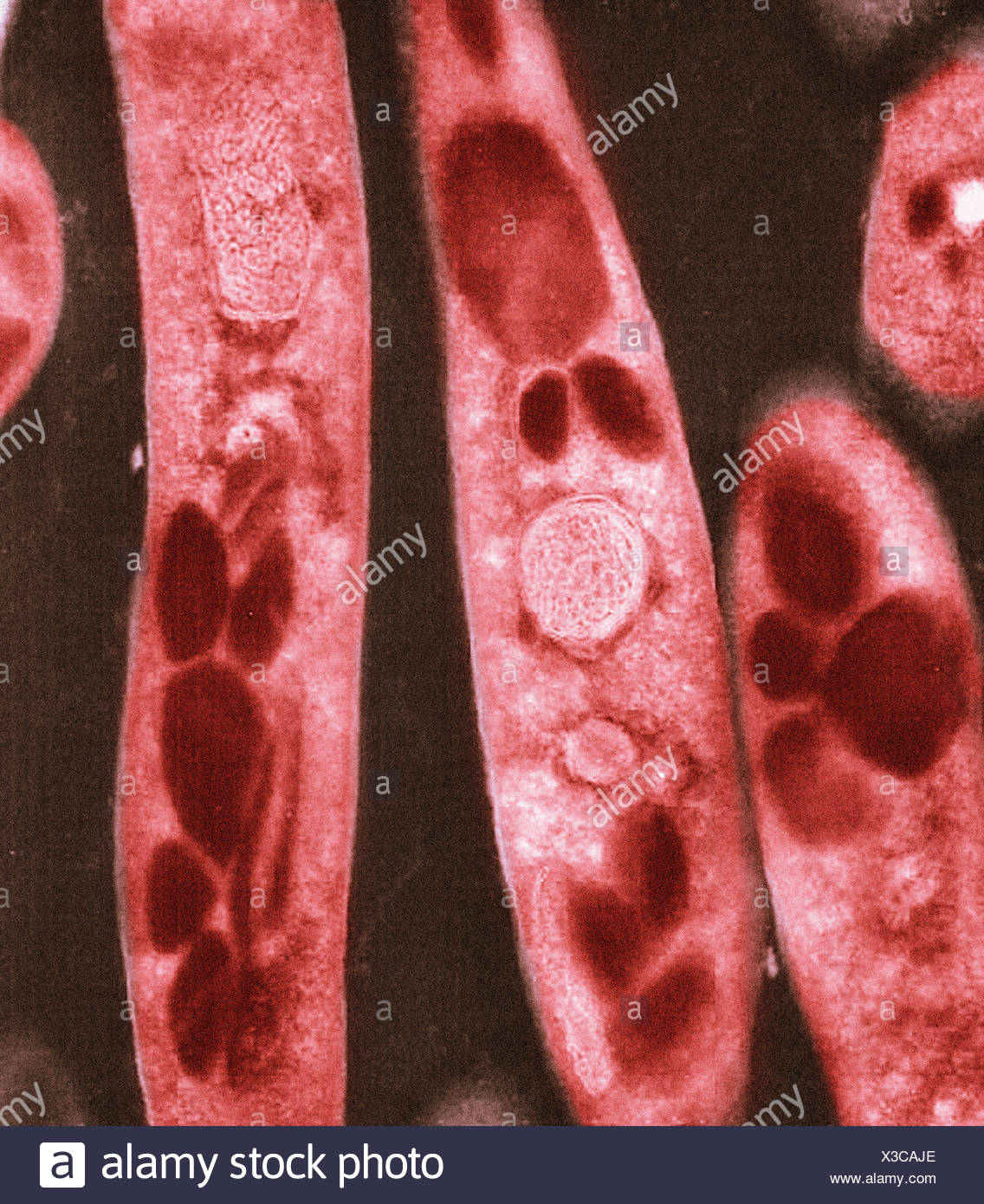 Electron Micrograph Bacillus Anthracis Bacteria Stock Photos & Electron ...