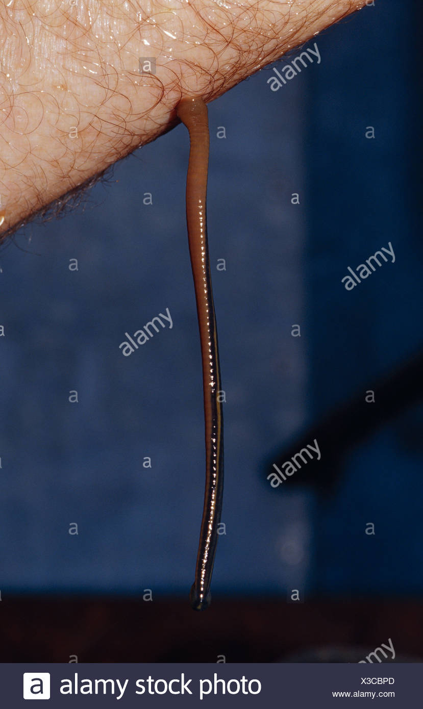 Leech Breeding High Resolution Stock Photography and Images - Alamy