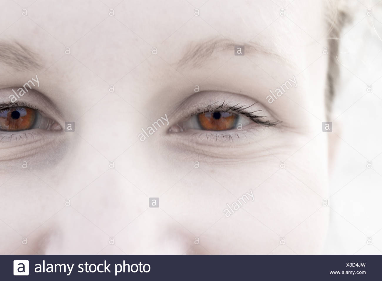 Albino Human Eye High Resolution Stock Photography and Images - Alamy