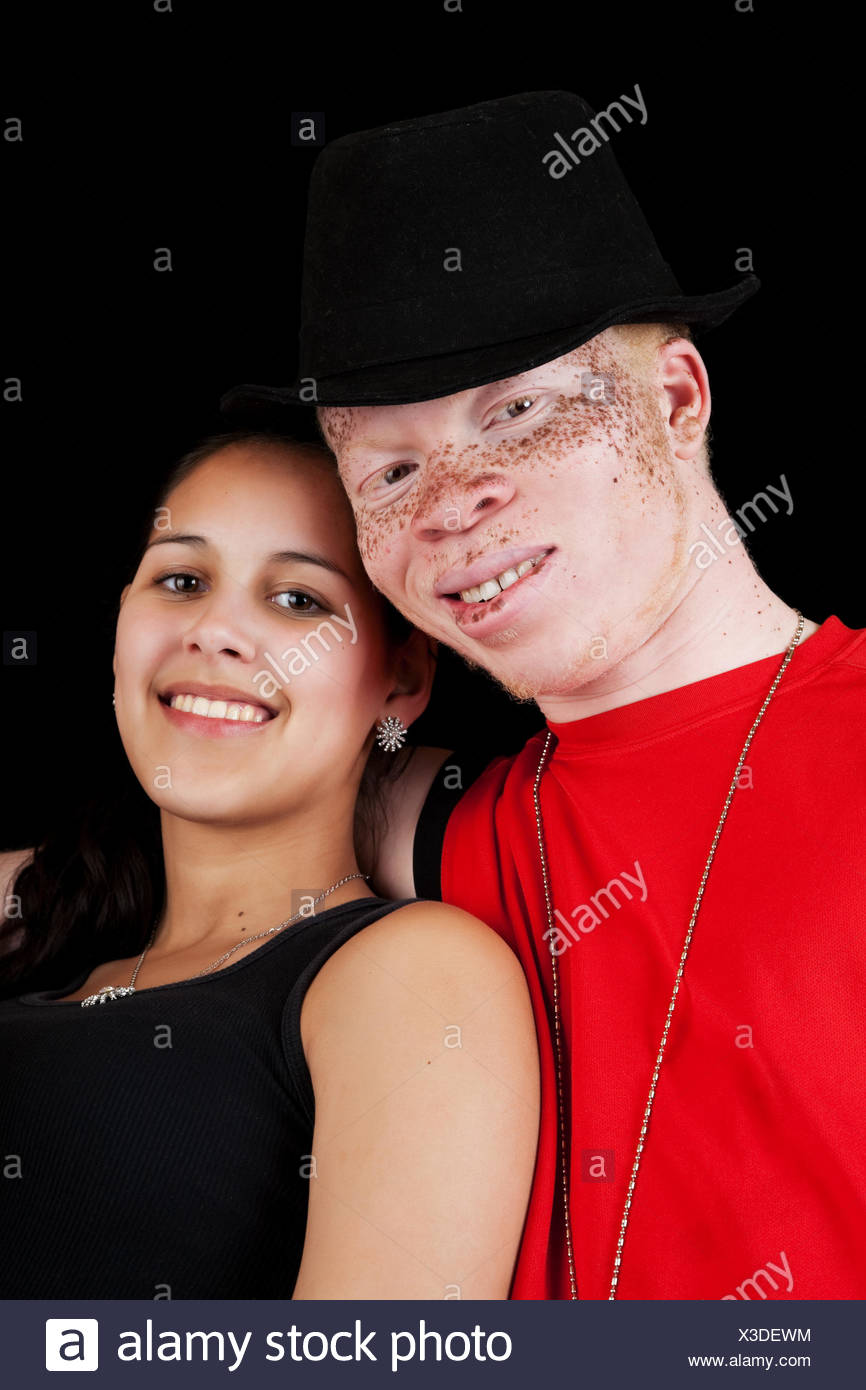 Black And Albino Couple High Resolution Stock Photography and Images ...