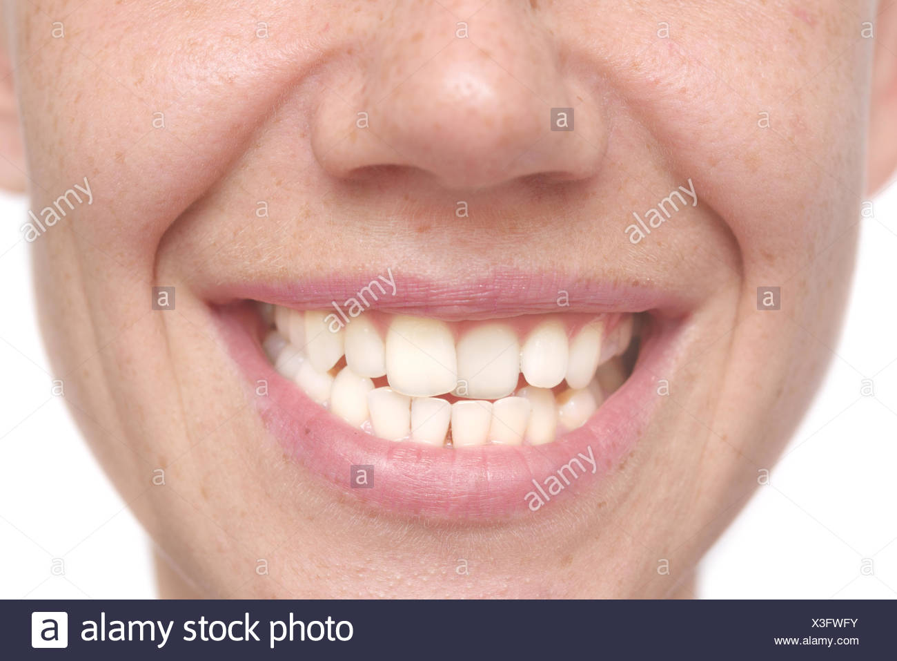 Crooked Teeth High Resolution Stock Photography and Images - Alamy