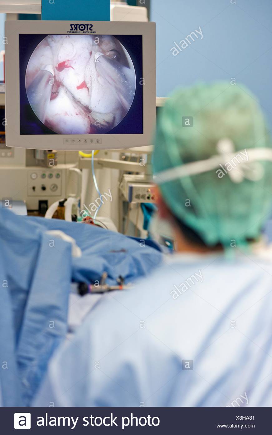 Transurethral Resection High Resolution Stock Photography and Images ...