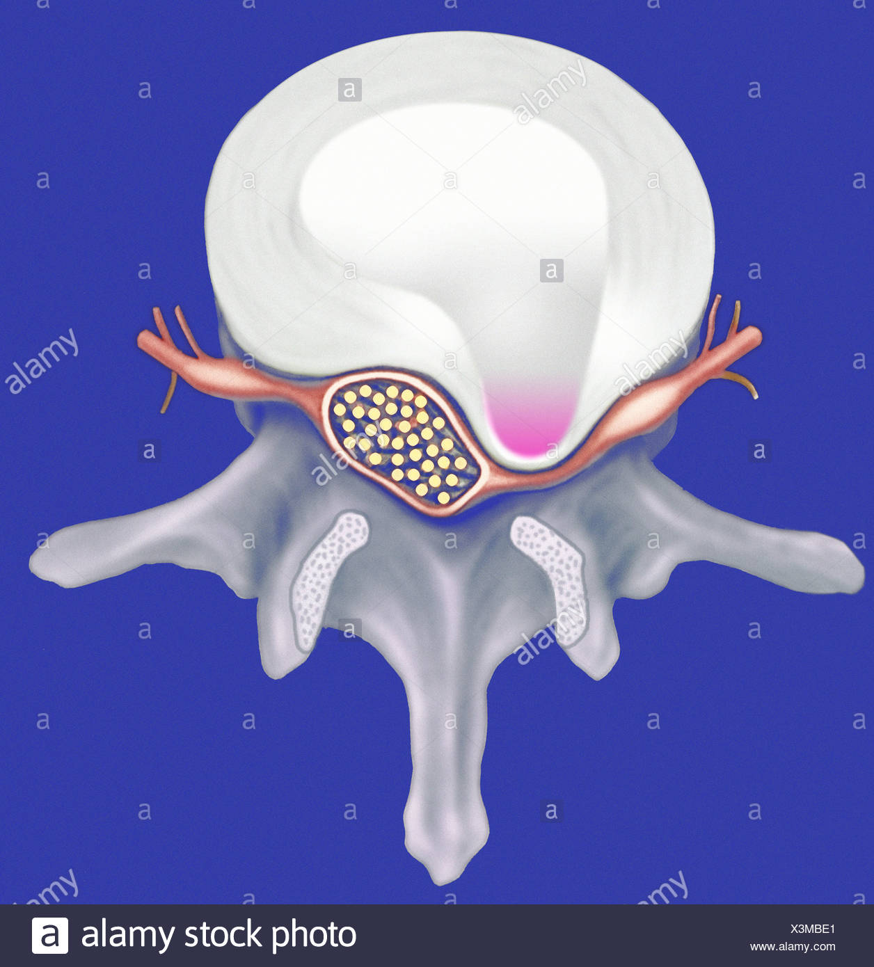 Spinal Disc Stock Photos & Spinal Disc Stock Images - Alamy