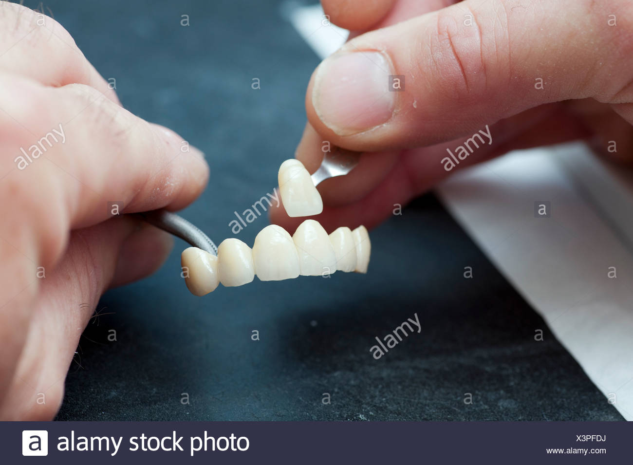 Dental Crowns High Resolution Stock Photography and Images - Alamy