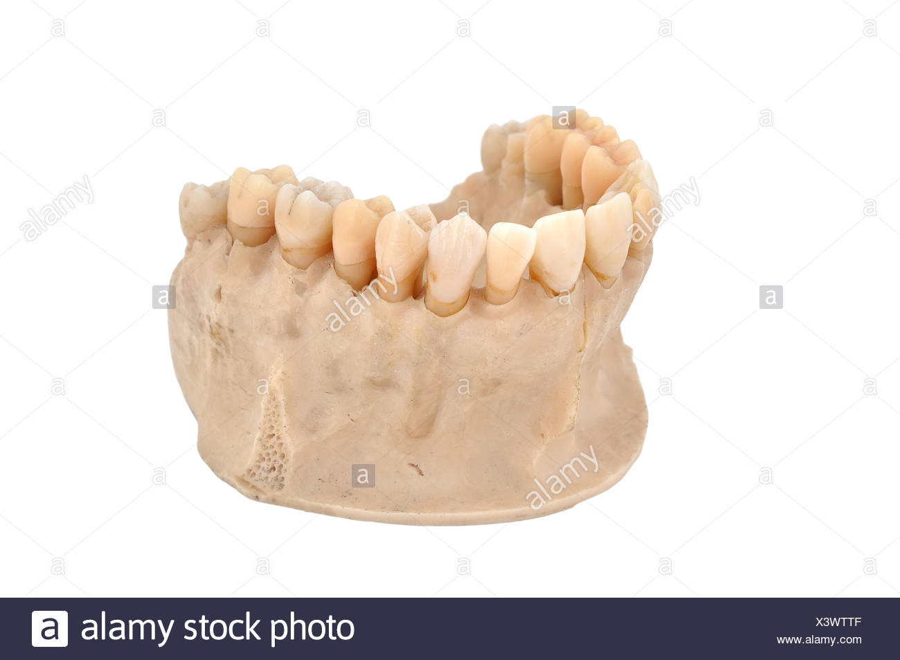Upper Jaw Bone Stock Photos & Upper Jaw Bone Stock Images - Alamy