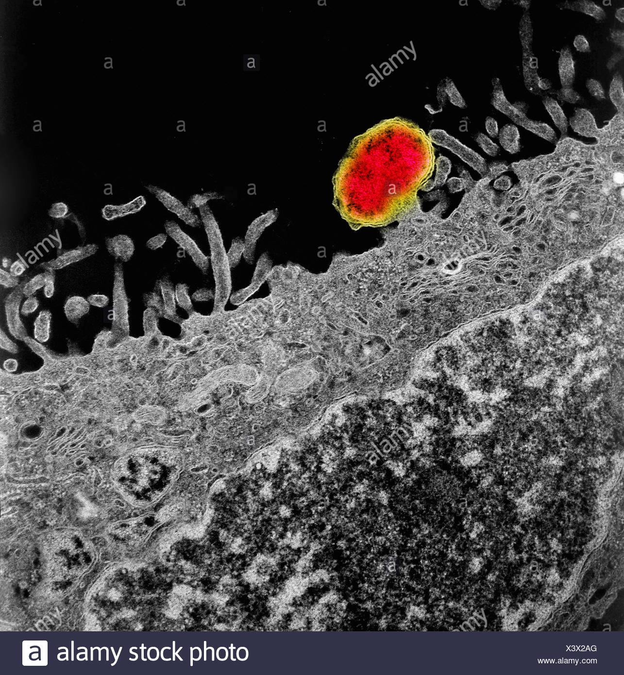 Orientia Tsutsugamushi Rickettsia High Resolution Stock Photography and ...