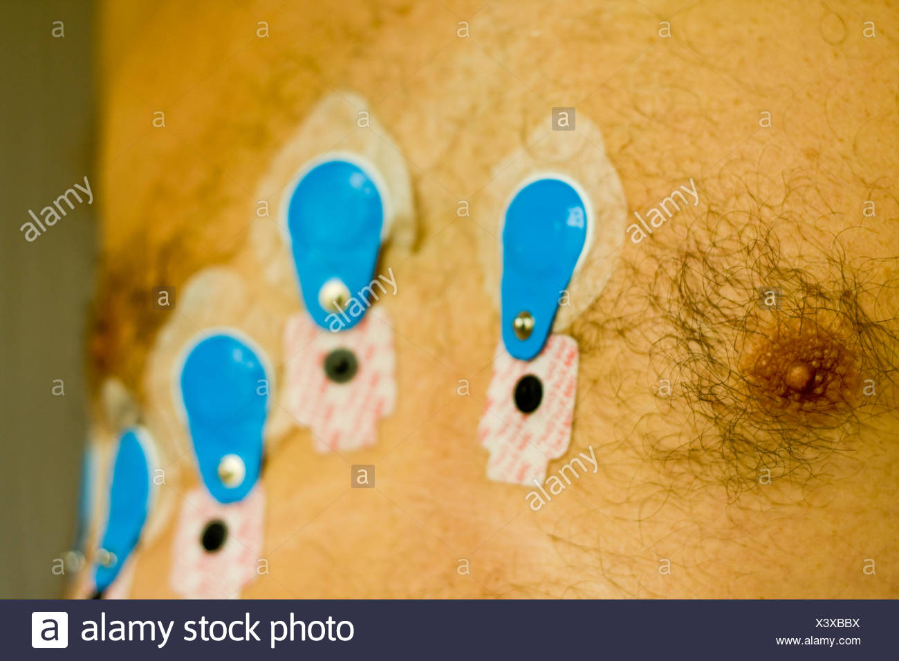 Ecg Electrocardiogram High Resolution Stock Photography and Images - Alamy