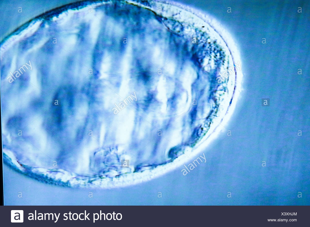 Blastocyst High Resolution Stock Photography and Images - Alamy