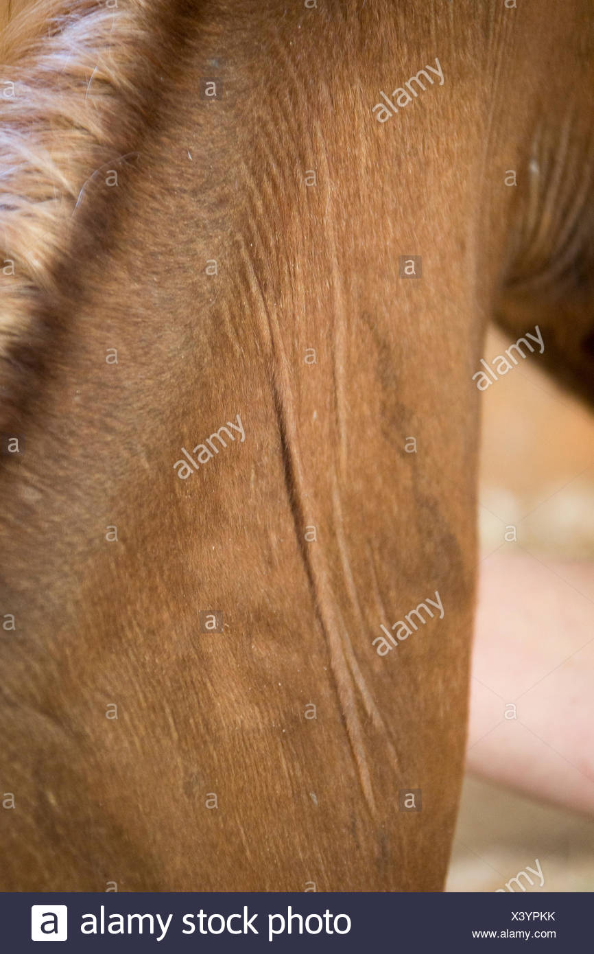 Pinched Skin High Resolution Stock Photography and Images - Alamy