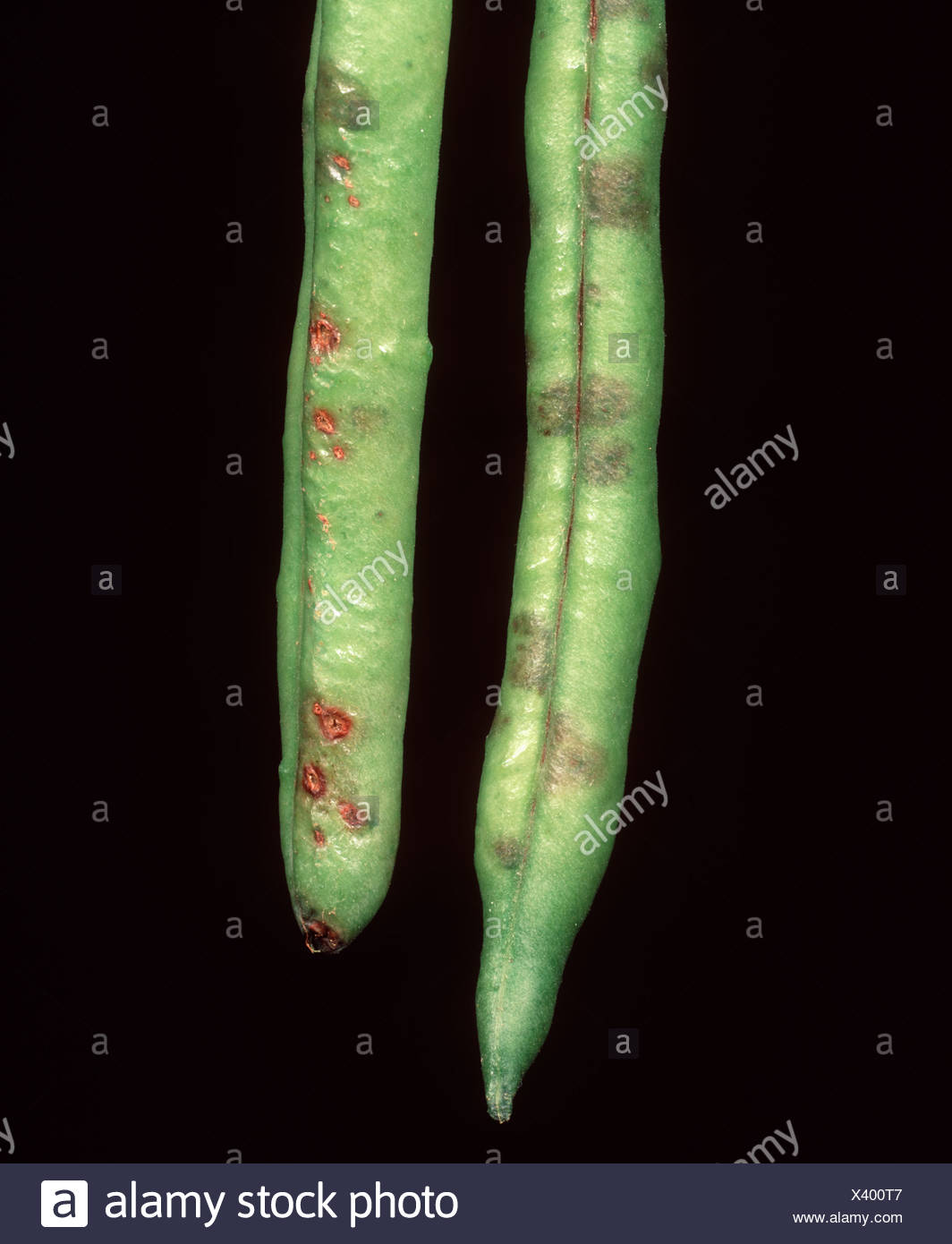 Xanthomonas Campestris High Resolution Stock Photography and Images - Alamy