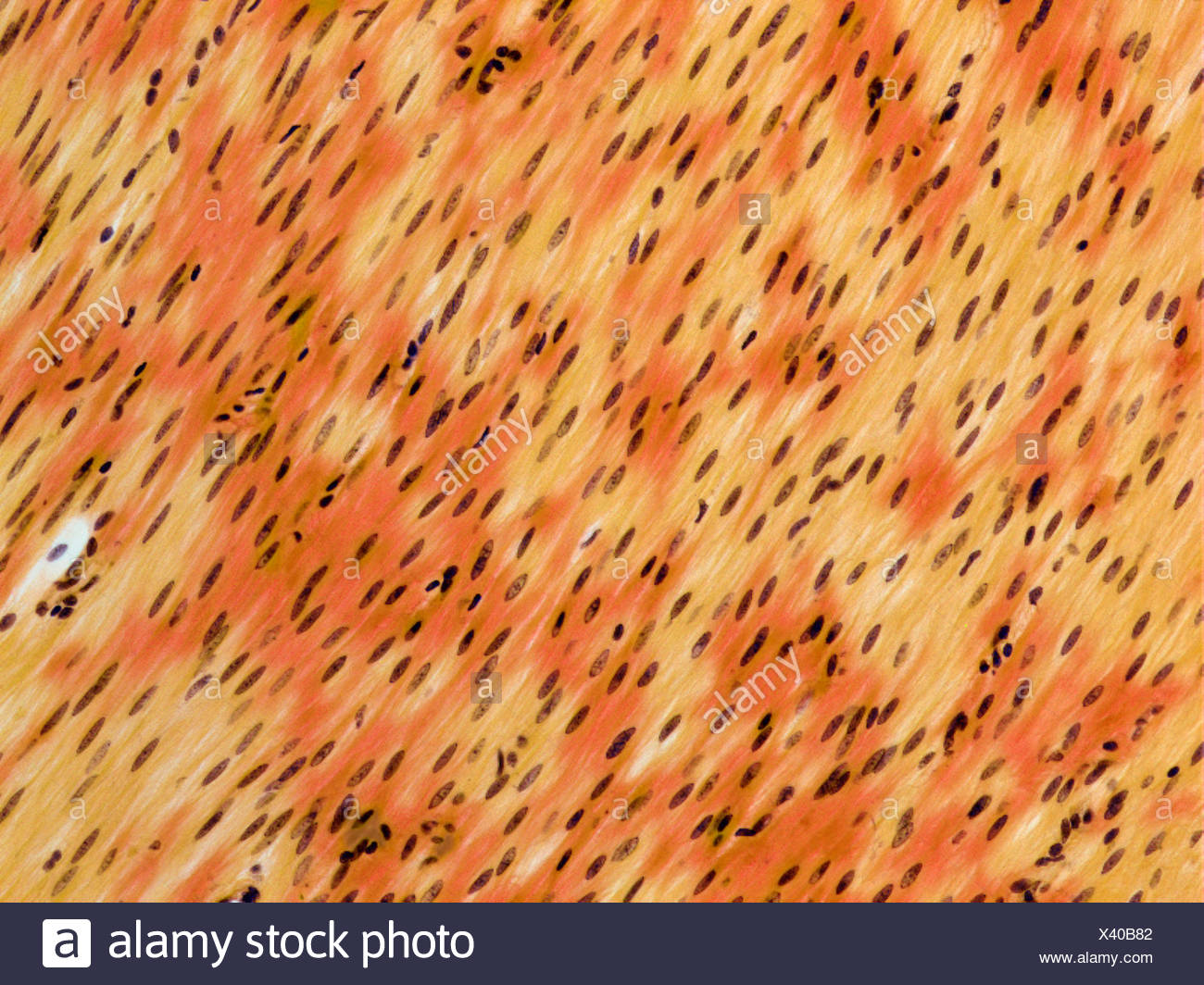 Smooth Muscle Micrograph High Resolution Stock Photography and Images ...