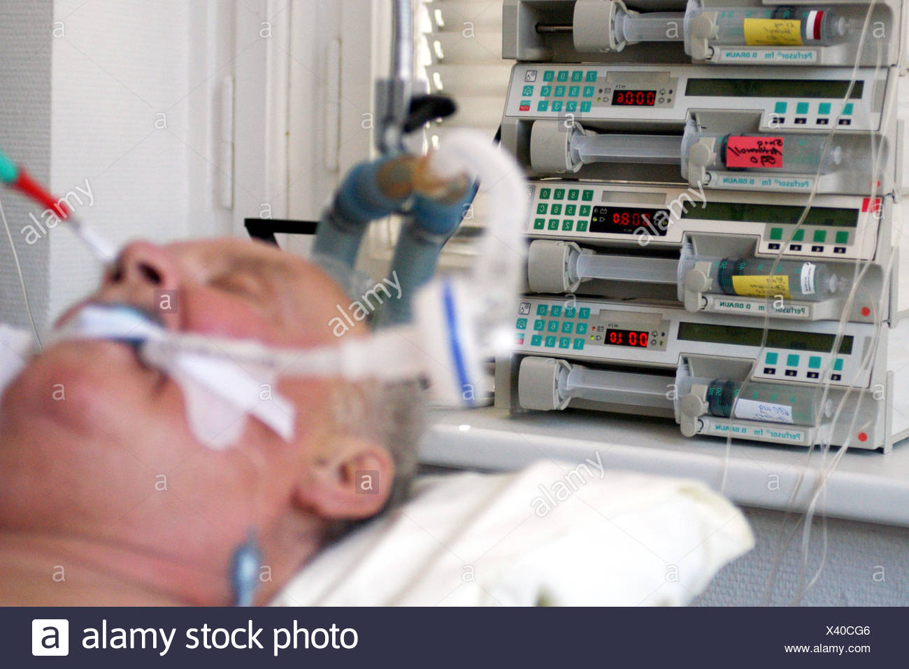 Artificial Coma High Resolution Stock Photography and Images - Alamy