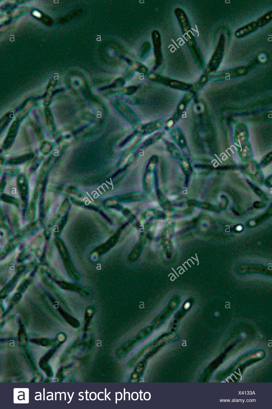 Bacillus Anthracis Micrograph High Resolution Stock Photography and ...