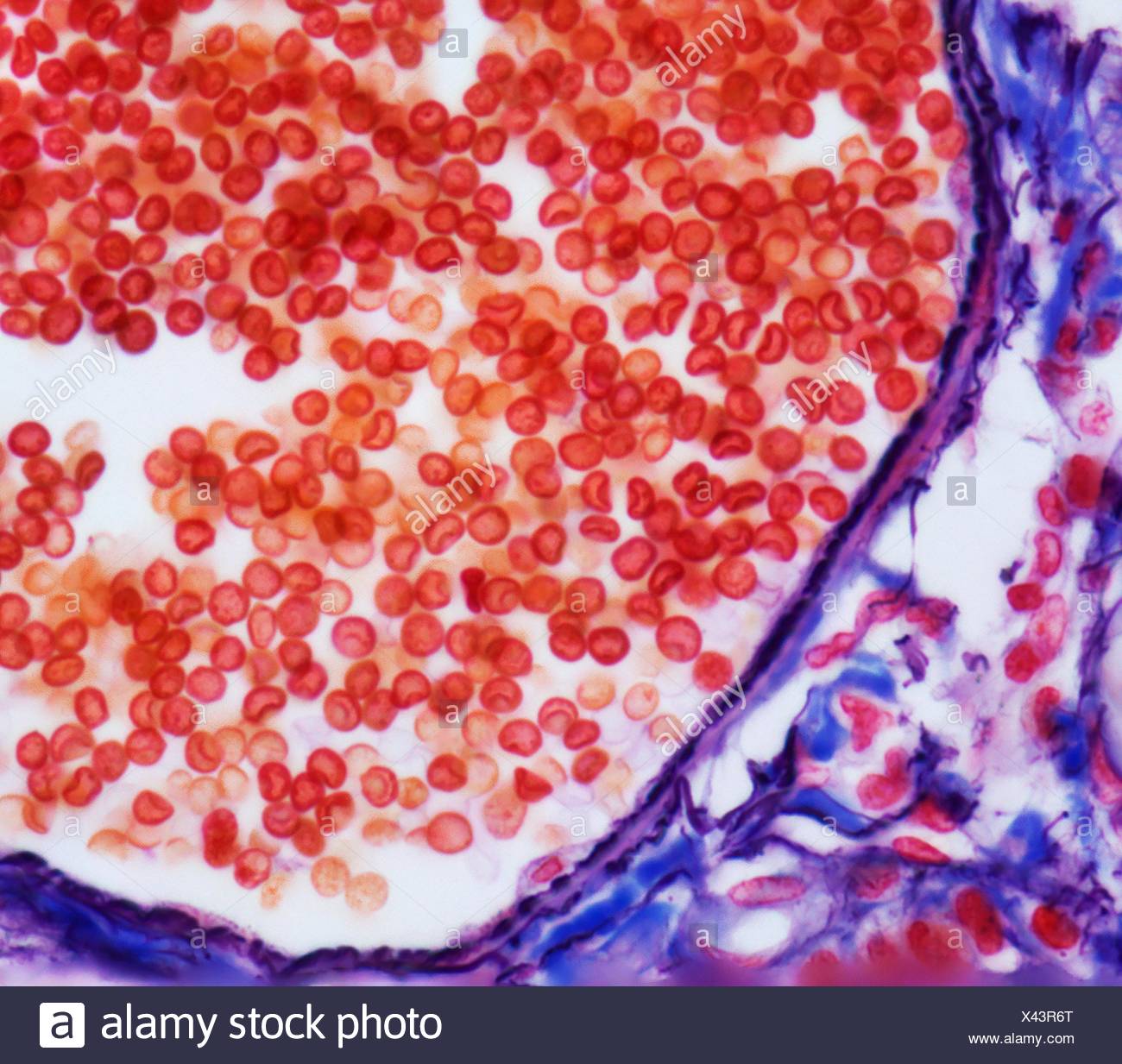 Red Blood Cell Light Micrograph High Resolution Stock Photography and ...