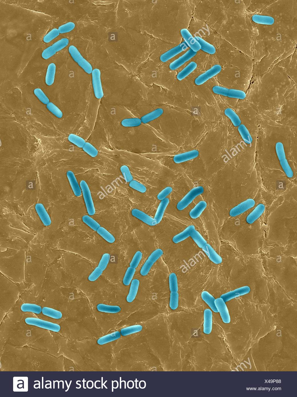 Anaerobic Bacterial Infections High Resolution Stock Photography and ...