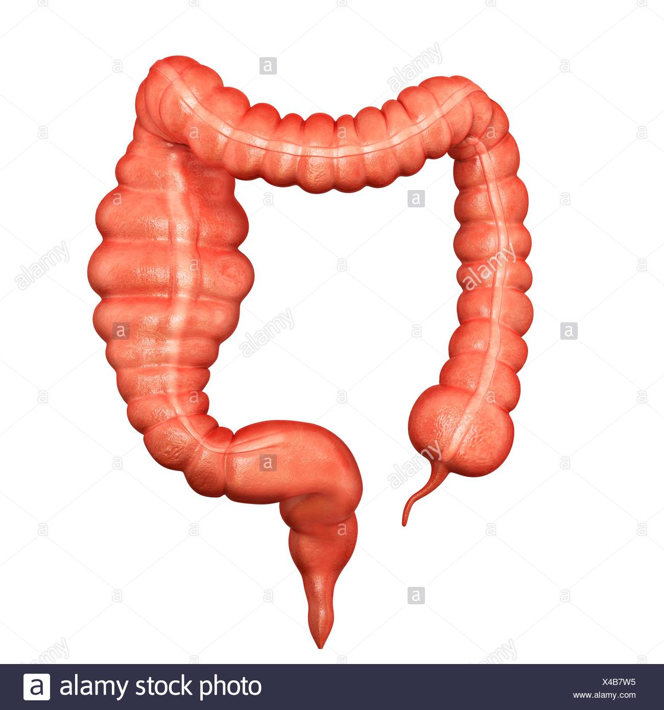 Megacolon High Resolution Stock Photography and Images - Alamy