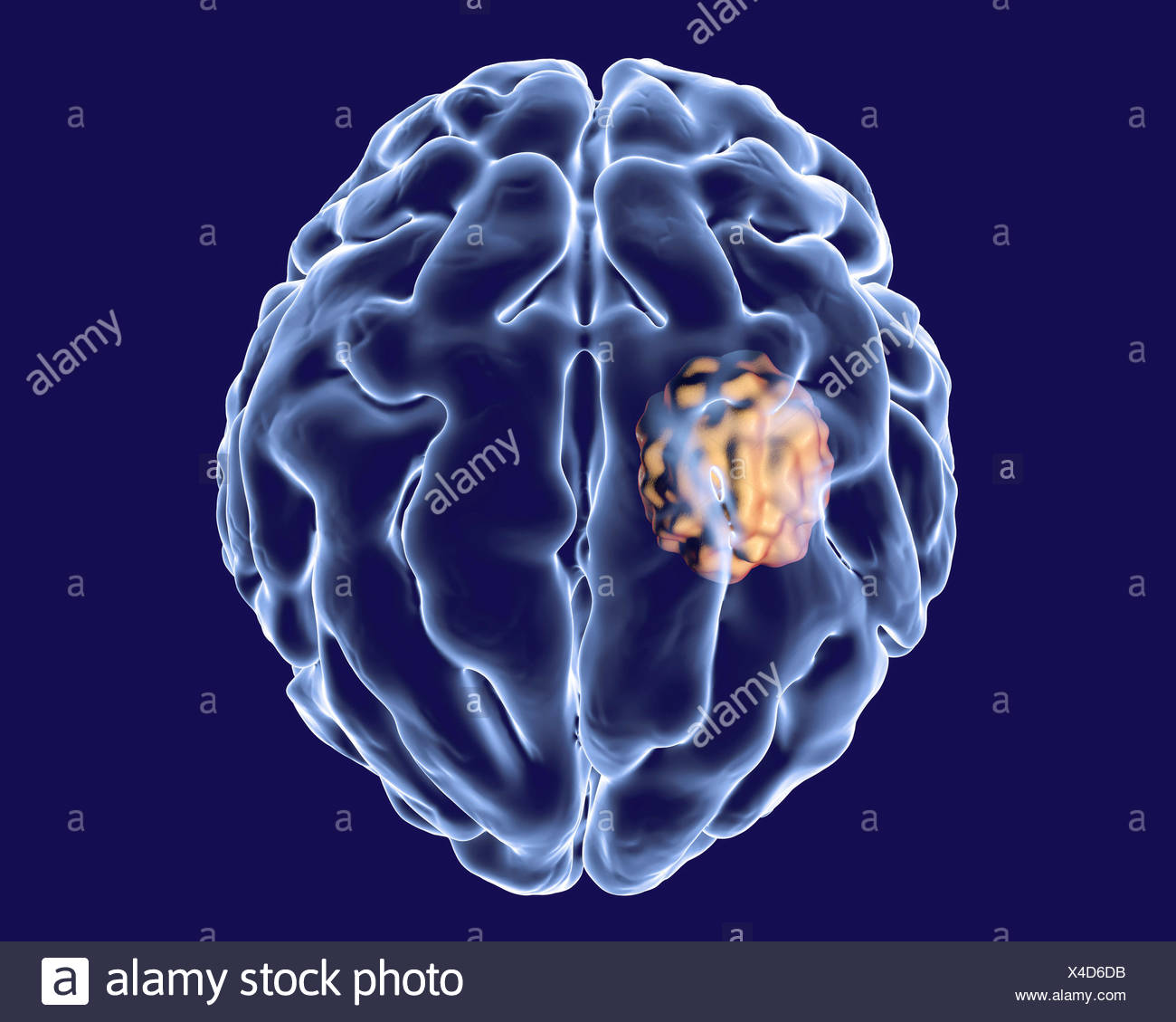 Aspergillus Fumigatus Fungus High Resolution Stock Photography and ...