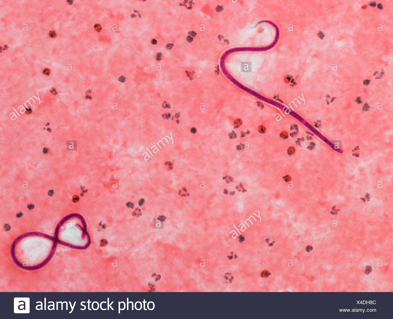 Microfilaria High Resolution Stock Photography and Images - Alamy