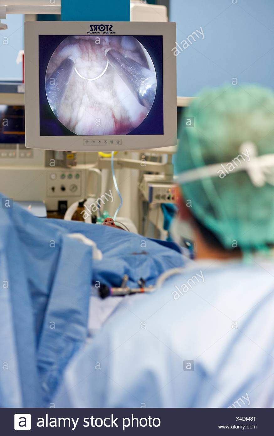 Transurethral Resection High Resolution Stock Photography and Images ...