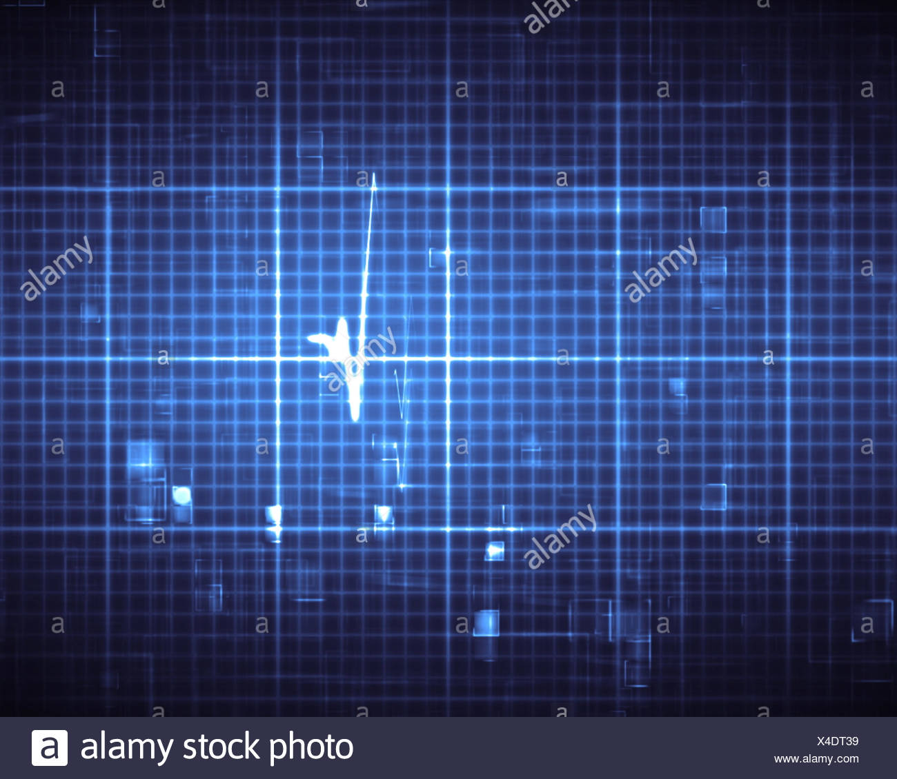 Electrocardiography Ecg High Resolution Stock Photography and Images ...