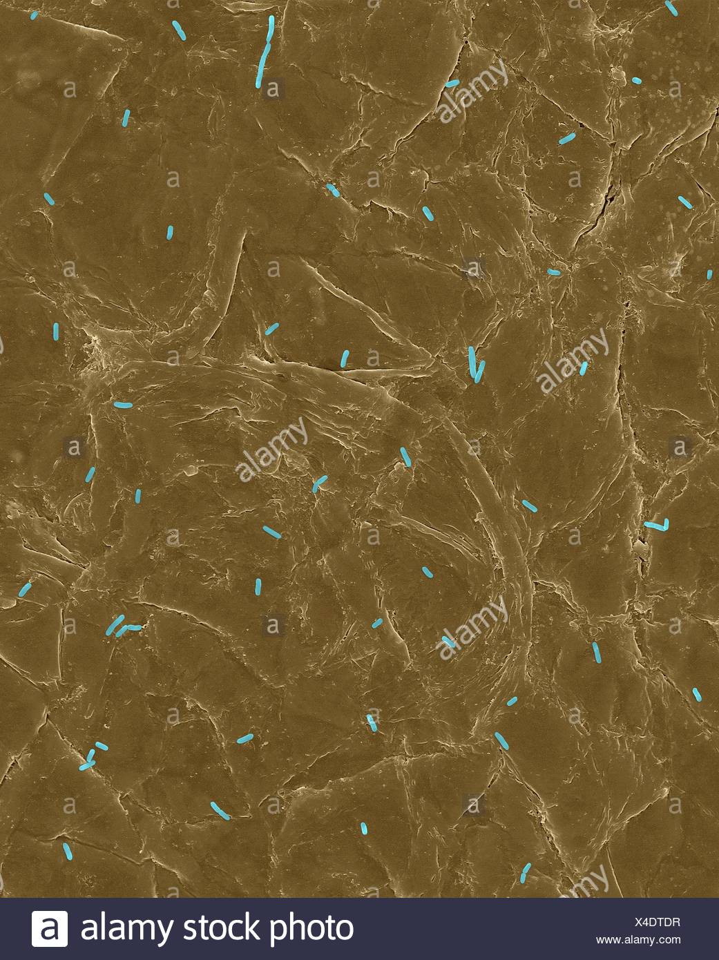 Escherichia Coli Bacteria, Sem High Resolution Stock Photography and ...