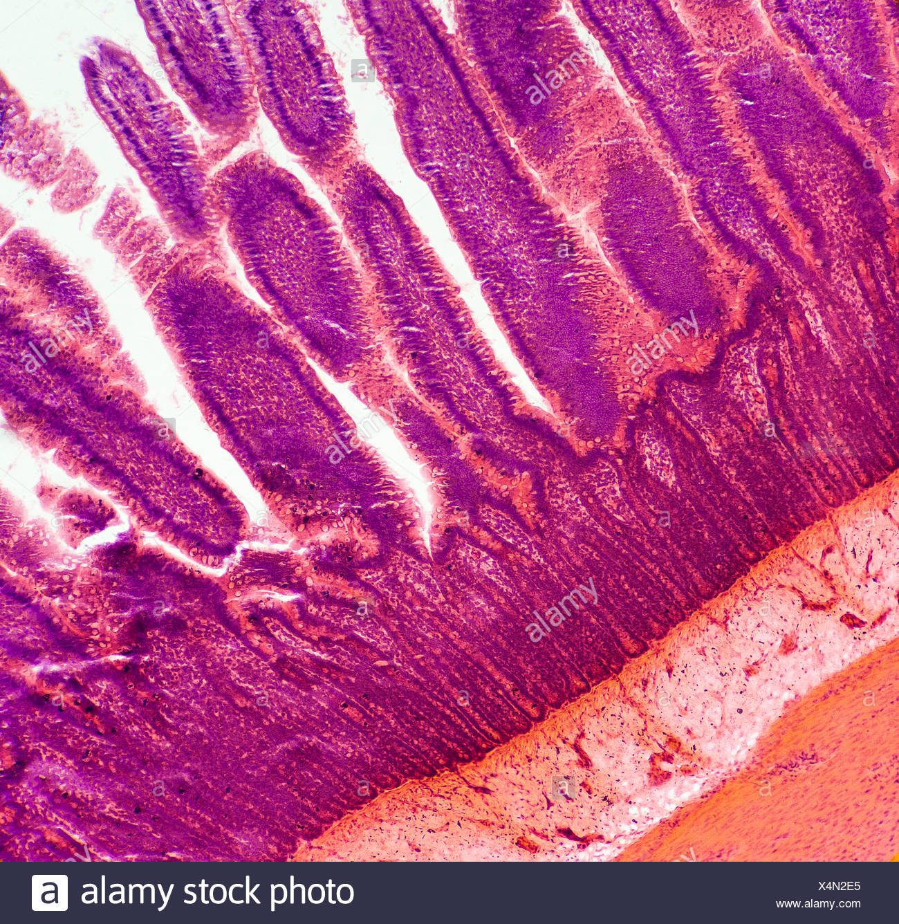 Small Intestine Villi Stock Photos & Small Intestine Villi Stock Images ...