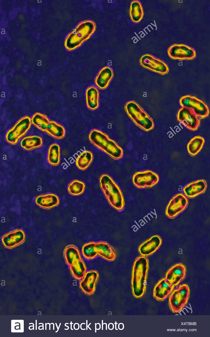 Yersinia Pestis Bacterium Stock Photos & Yersinia Pestis Bacterium ...