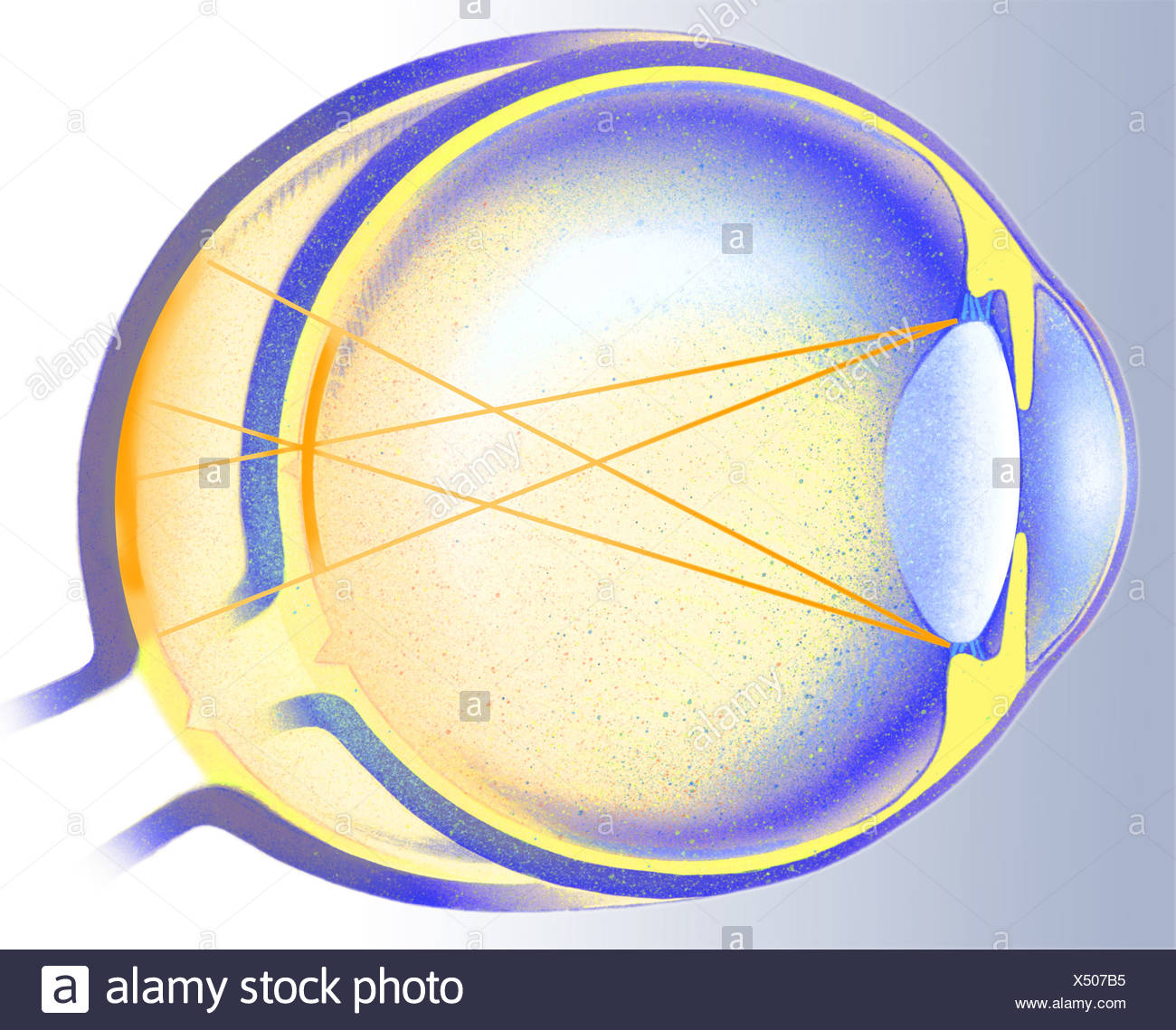 Nearsighted Stock Photos & Nearsighted Stock Images - Alamy