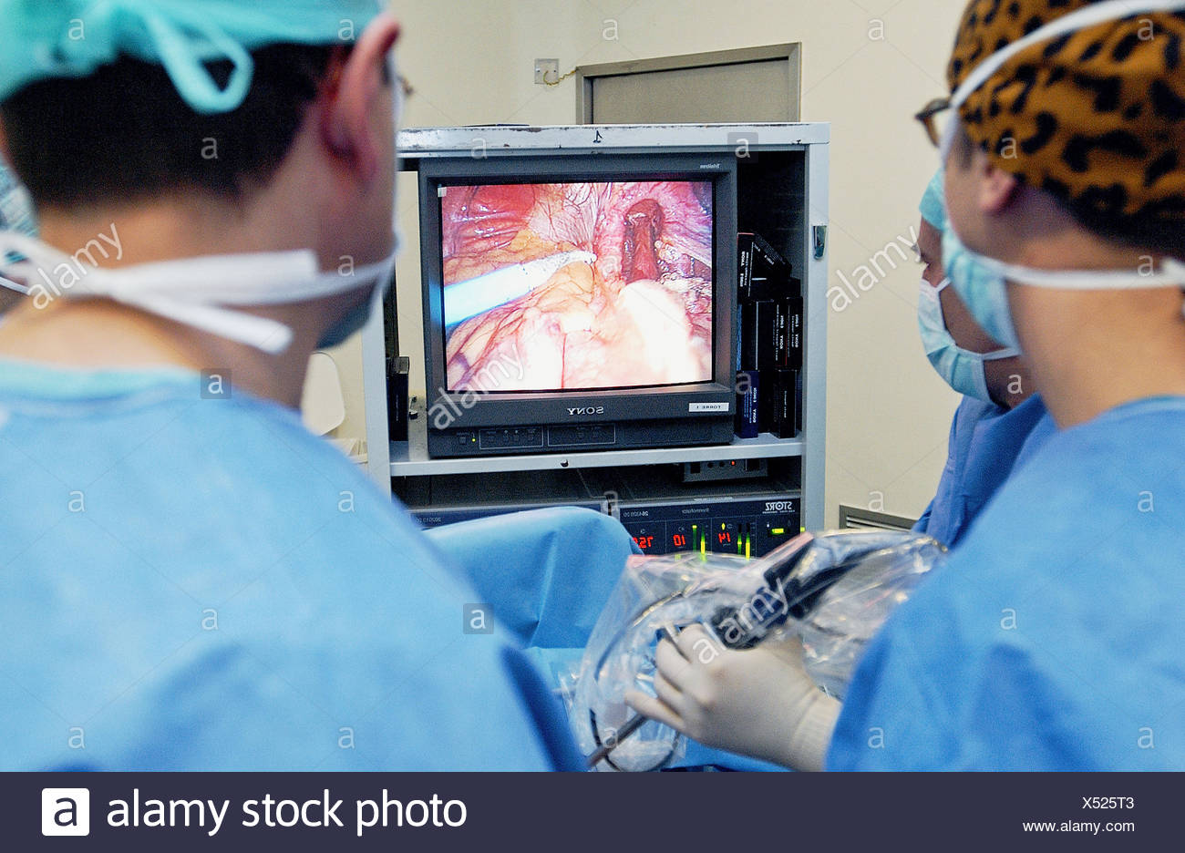 Laparoscopy Equipment Stock Photos & Laparoscopy Equipment Stock Images ...