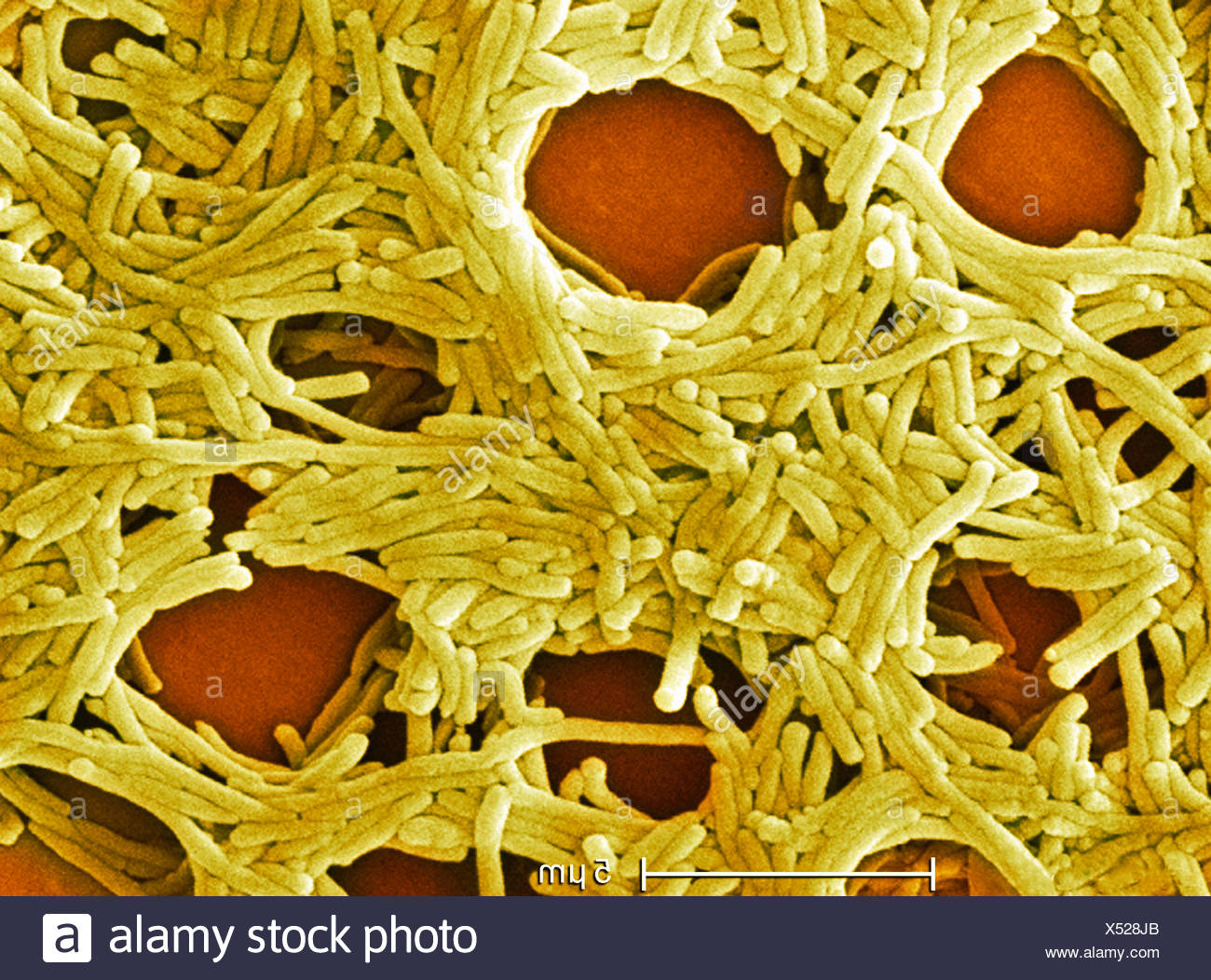 Micrograph Bacteria High Resolution Stock Photography and Images - Alamy