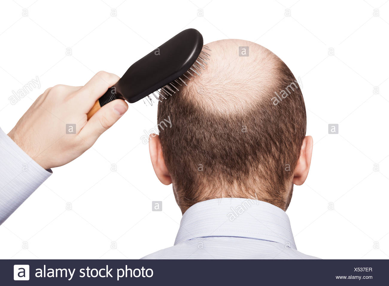 Bald Patch Stock Photos & Bald Patch Stock Images - Alamy