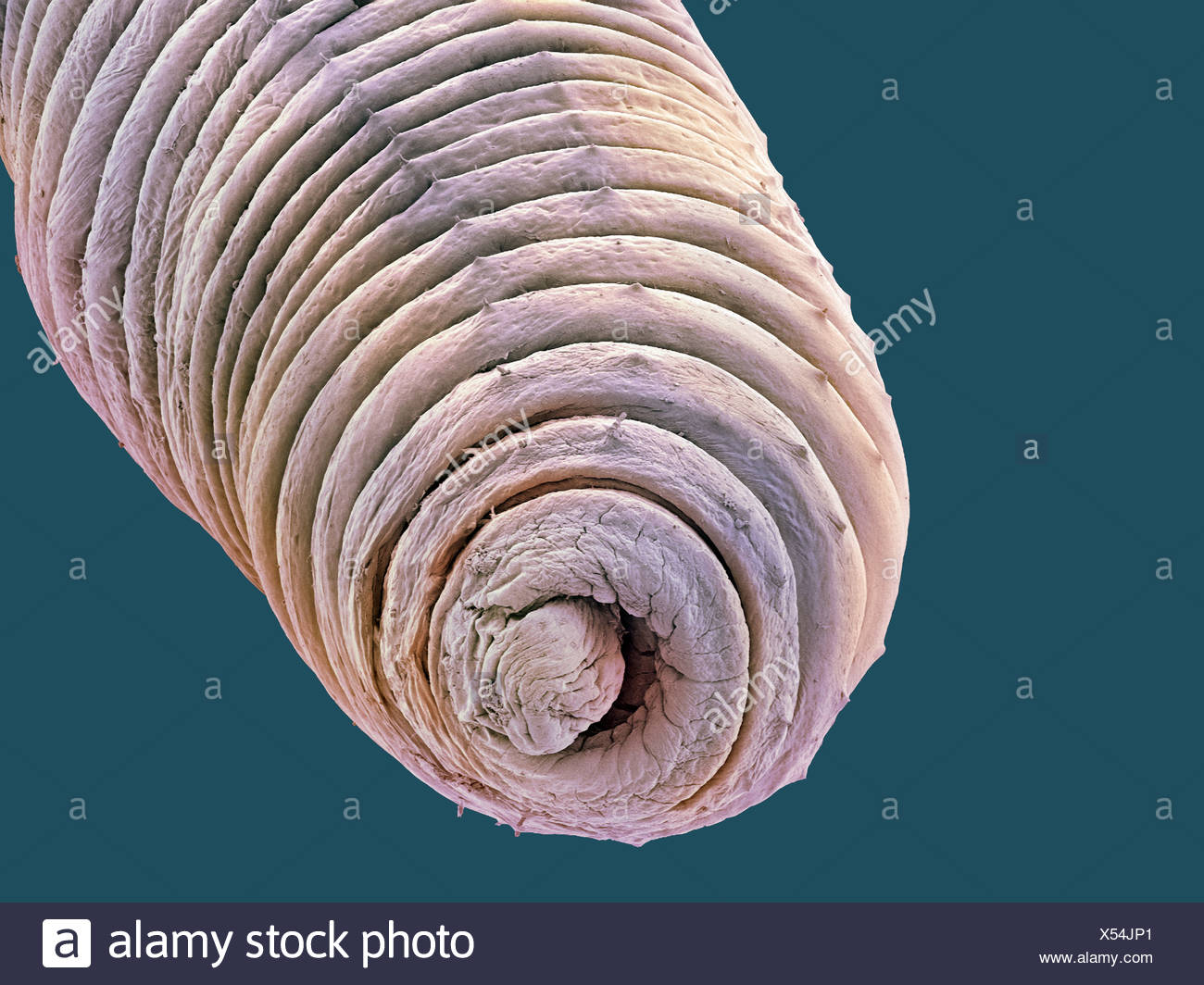 Earthworm Lumbricus Cross Section Earthworms Biology