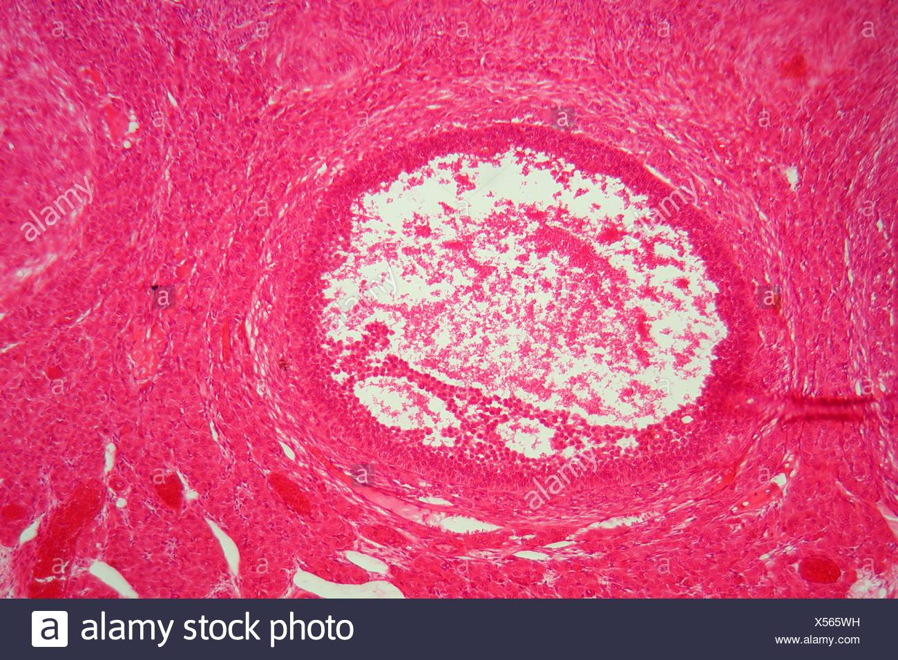 Ovary Micrograph High Resolution Stock Photography and Images - Alamy