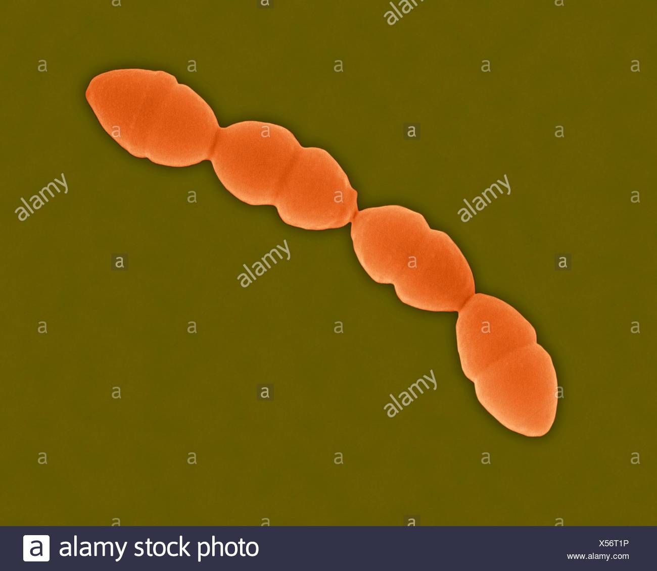 Streptococcus Pneumoniae Gram High Resolution Stock Photography and ...