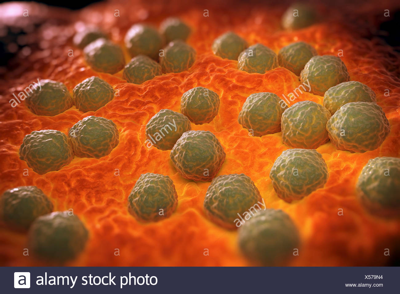 Congenital Rubella Syndrome High Resolution Stock Photography and ...