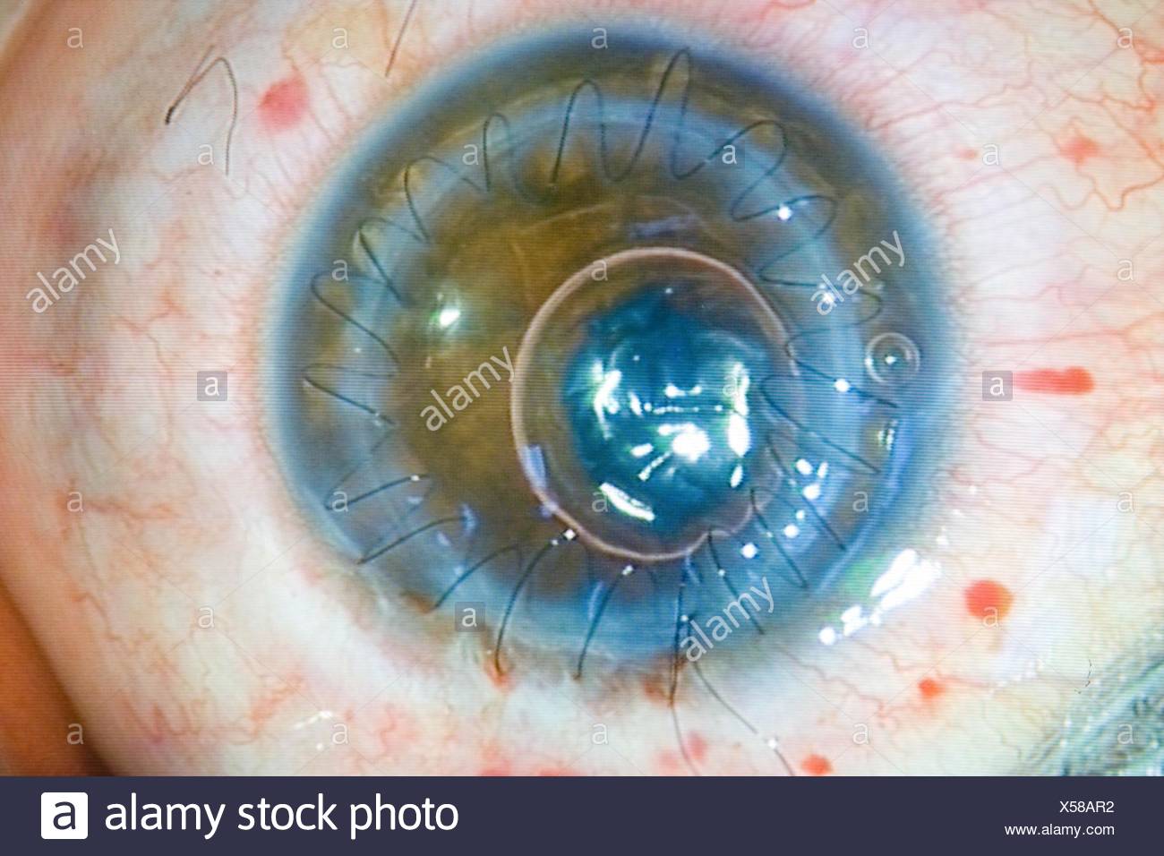 Stitch And Stitches High Resolution Stock Photography and Images - Alamy