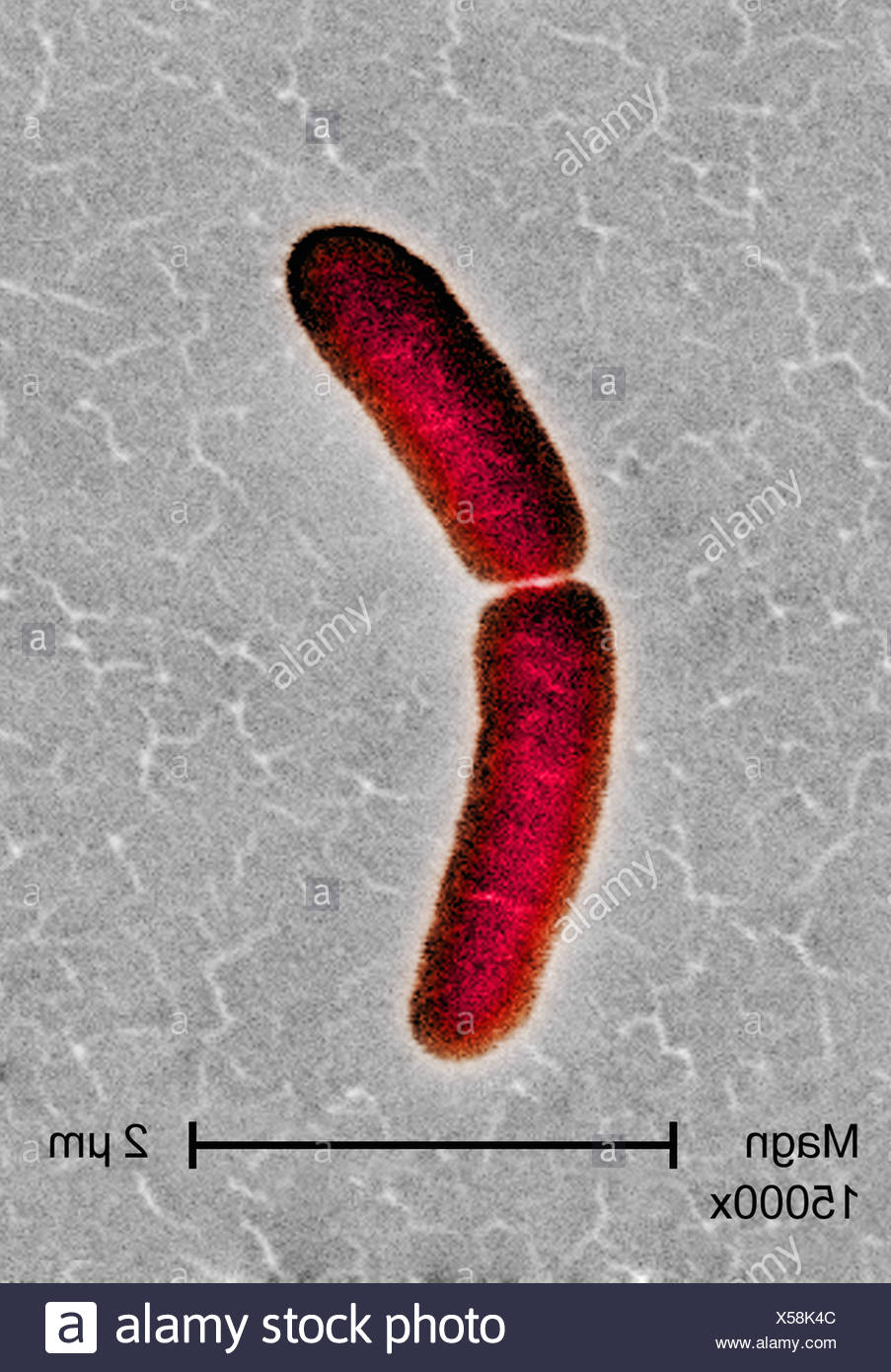 Salmonella Typhimurium High Resolution Stock Photography and Images - Alamy