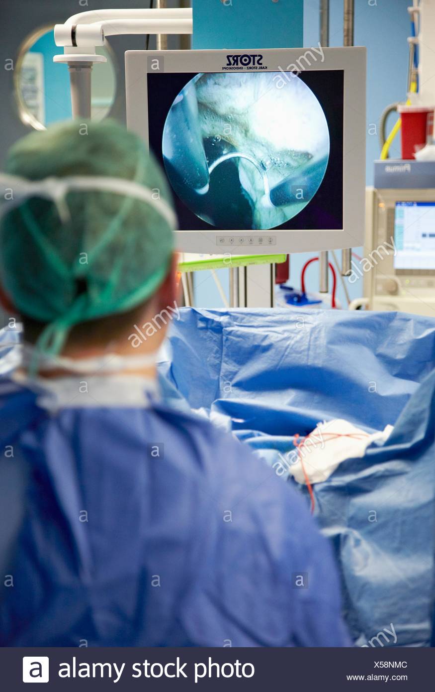 Prostate Surgery Bipolar Turp Transurethral High Resolution Stock ...