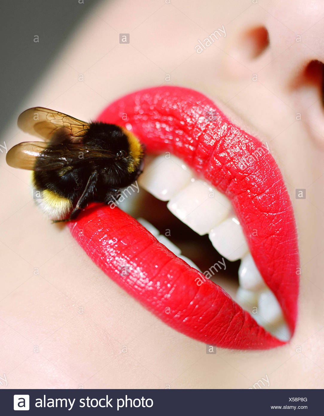 Bee Stung Lips High Resolution Stock Photography and Images - Alamy