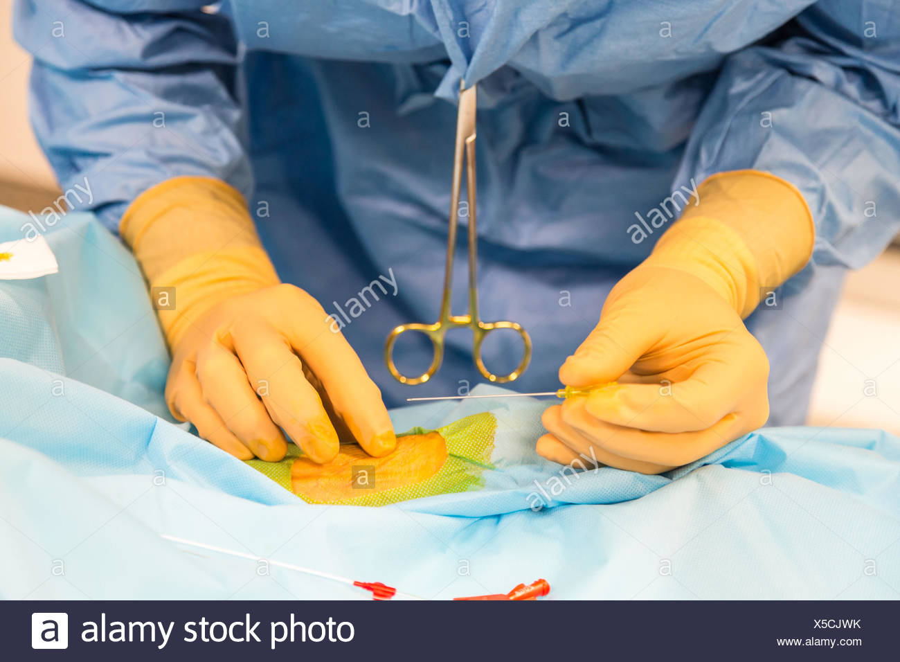 Radial Artery Stock Photos & Radial Artery Stock Images - Alamy