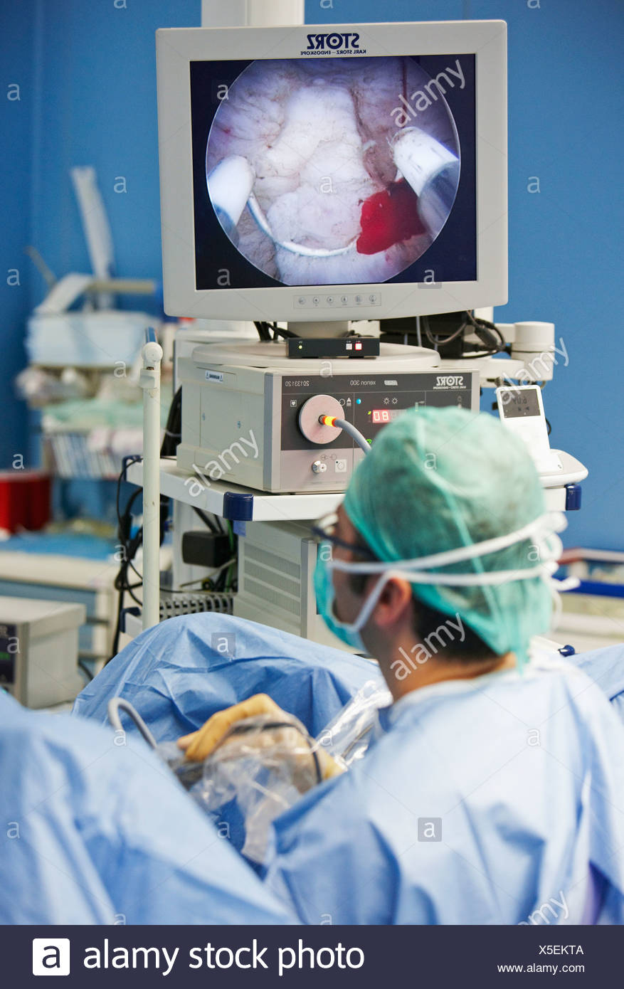 Transurethral High Resolution Stock Photography and Images - Alamy