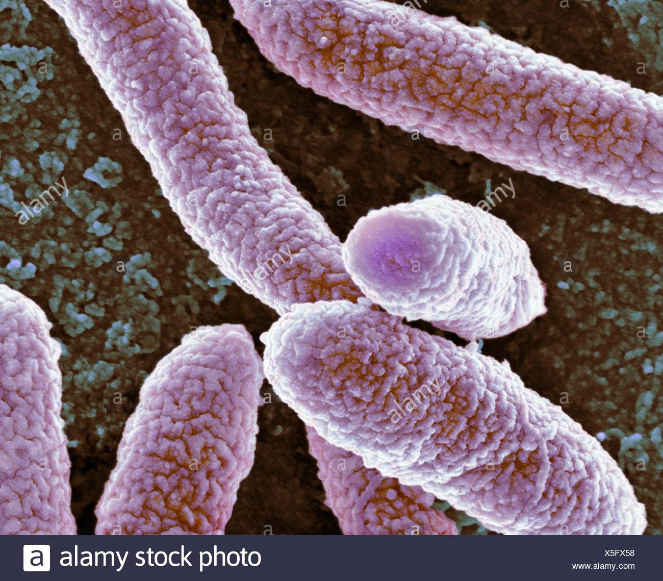 Escherichia Coli Microscope High Resolution Stock Photography and ...