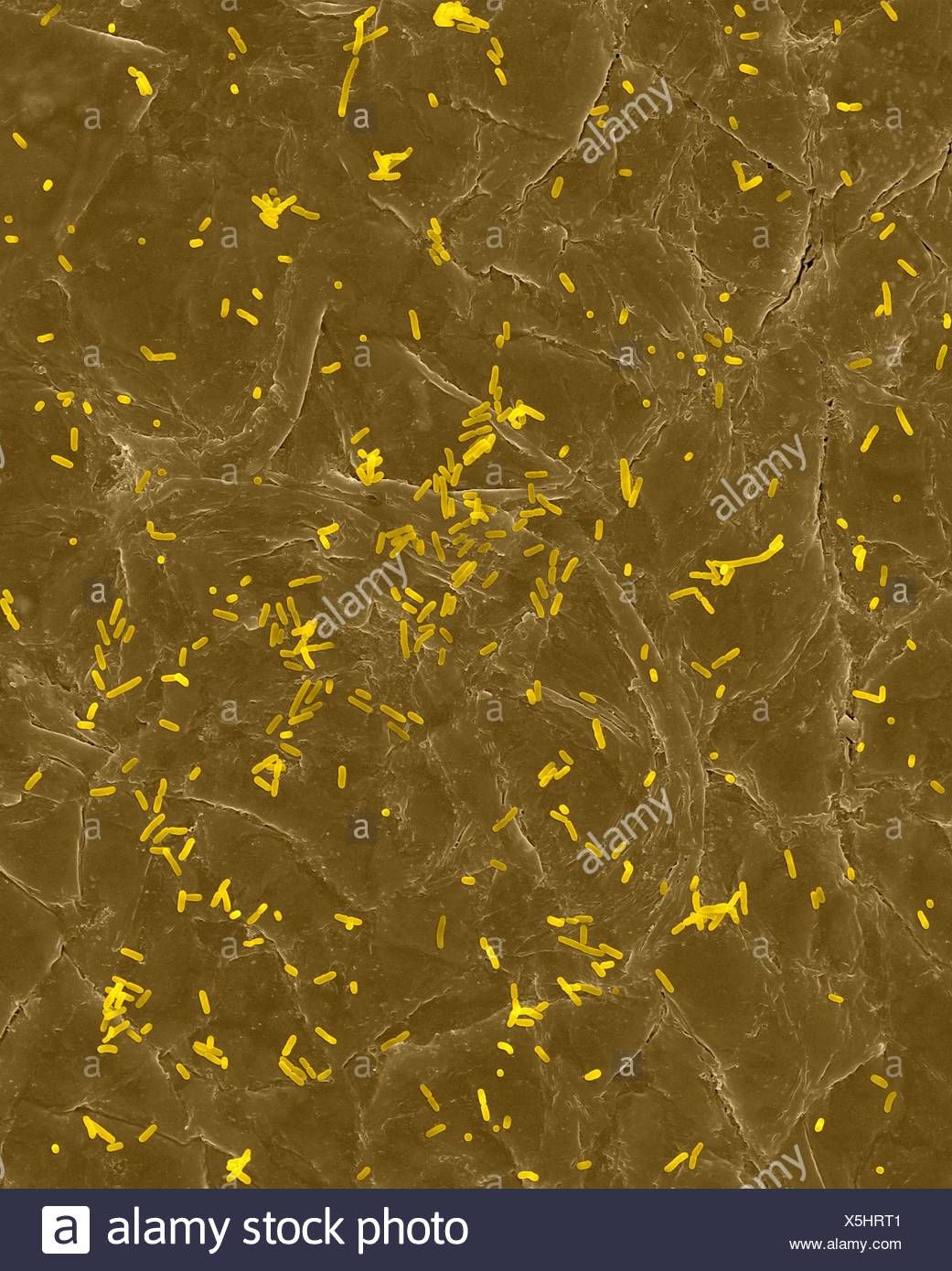 Meat Strains High Resolution Stock Photography and Images - Alamy