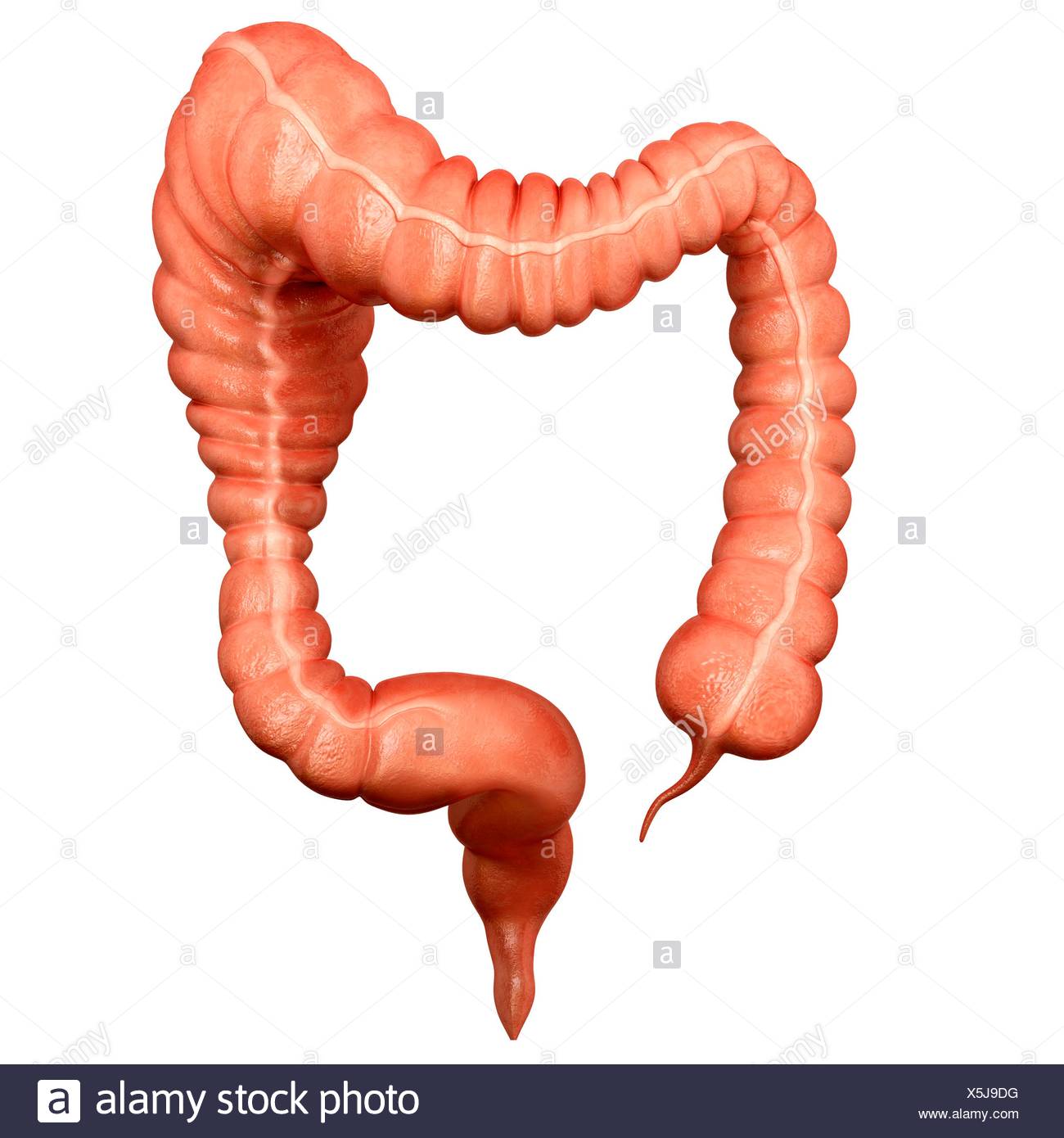 Megacolon High Resolution Stock Photography and Images - Alamy