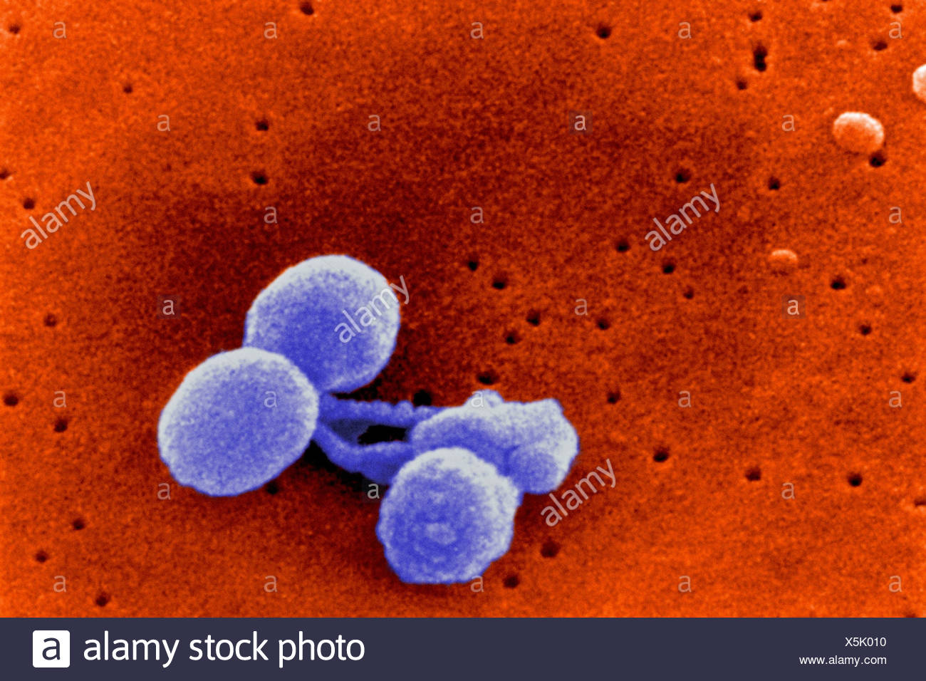 Streptococcus Pneumoniae Stock Photos & Streptococcus Pneumoniae Stock ...
